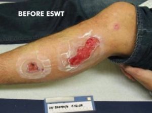 Act Now: 5 Urgent Signals Need To Visit Wound Care Clinic